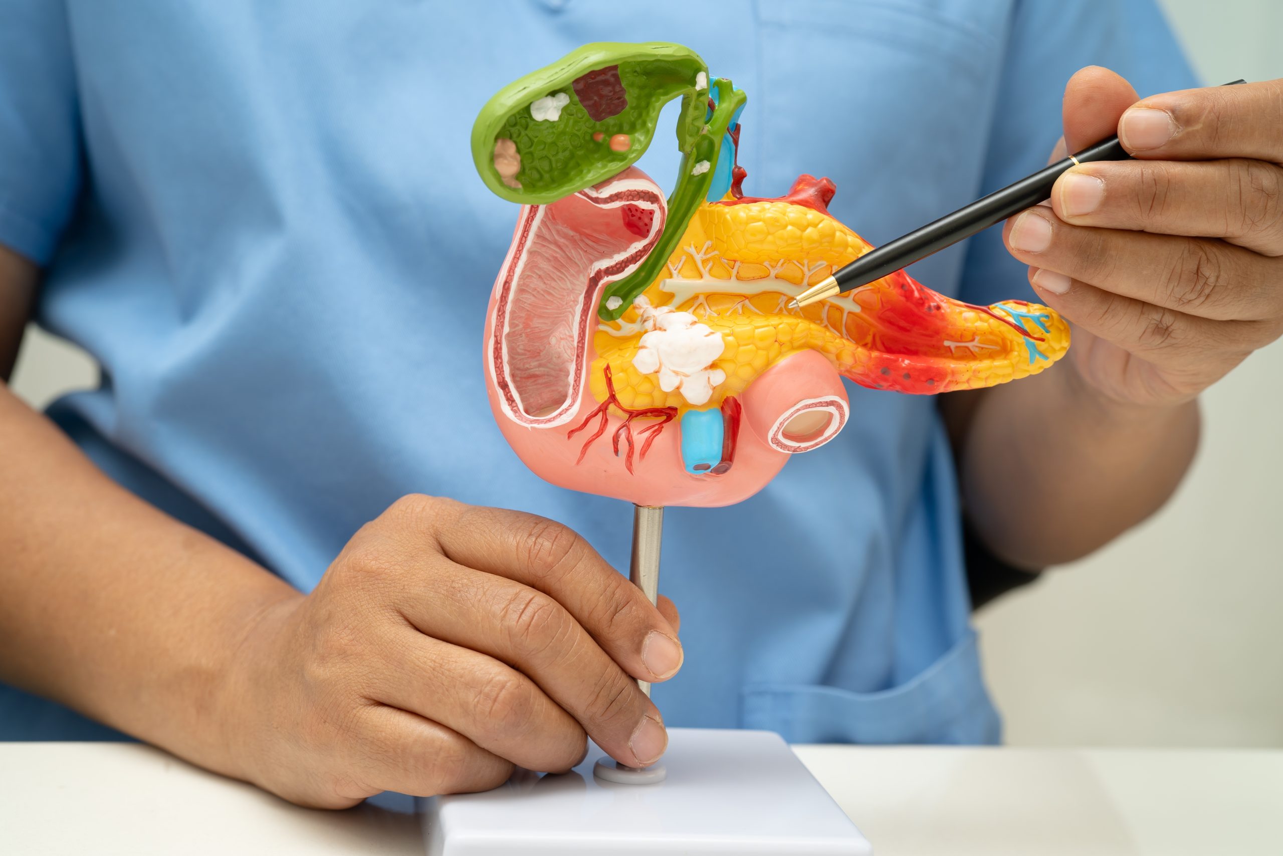 How to STARVE a Pancreatic Tumor – Health Insight