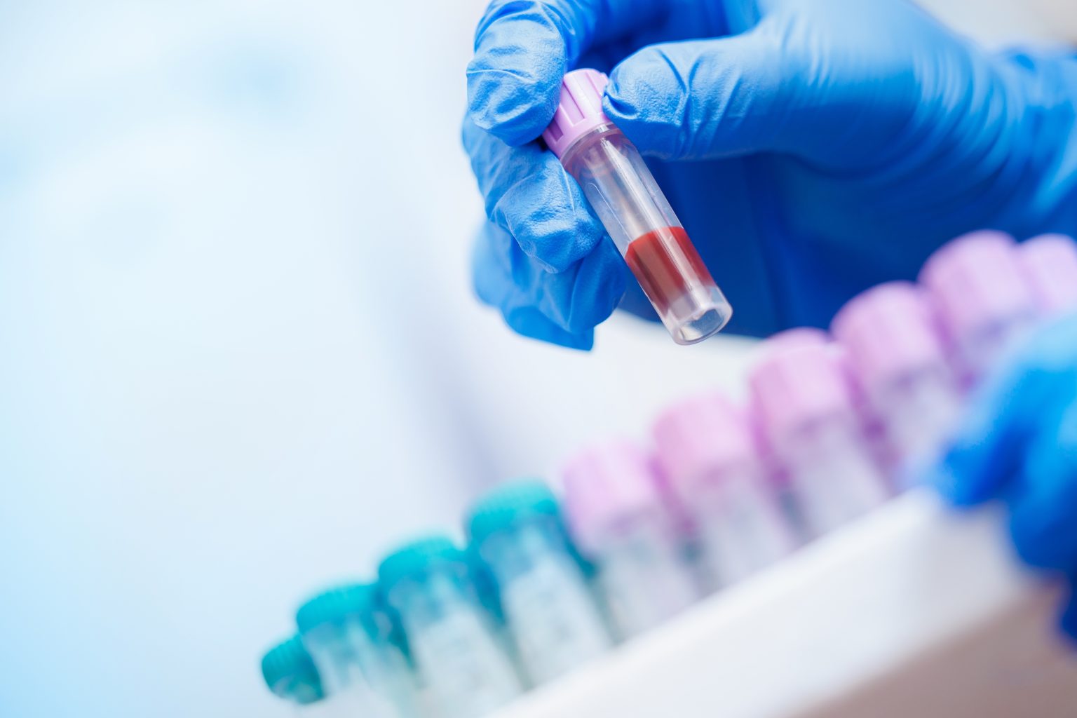 The Simple Blood Test Cancer Revolution – Health Insight