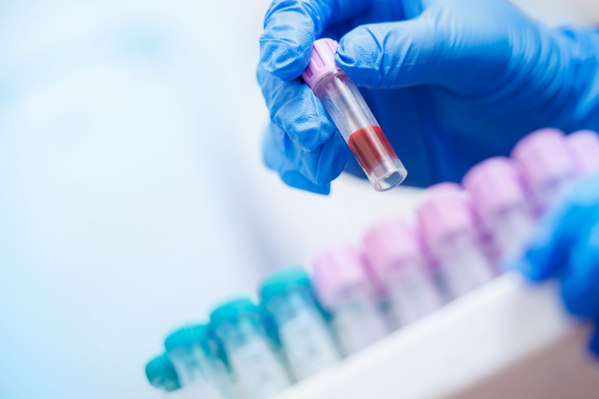 The Simple Blood Test Cancer Revolution – Health Insight