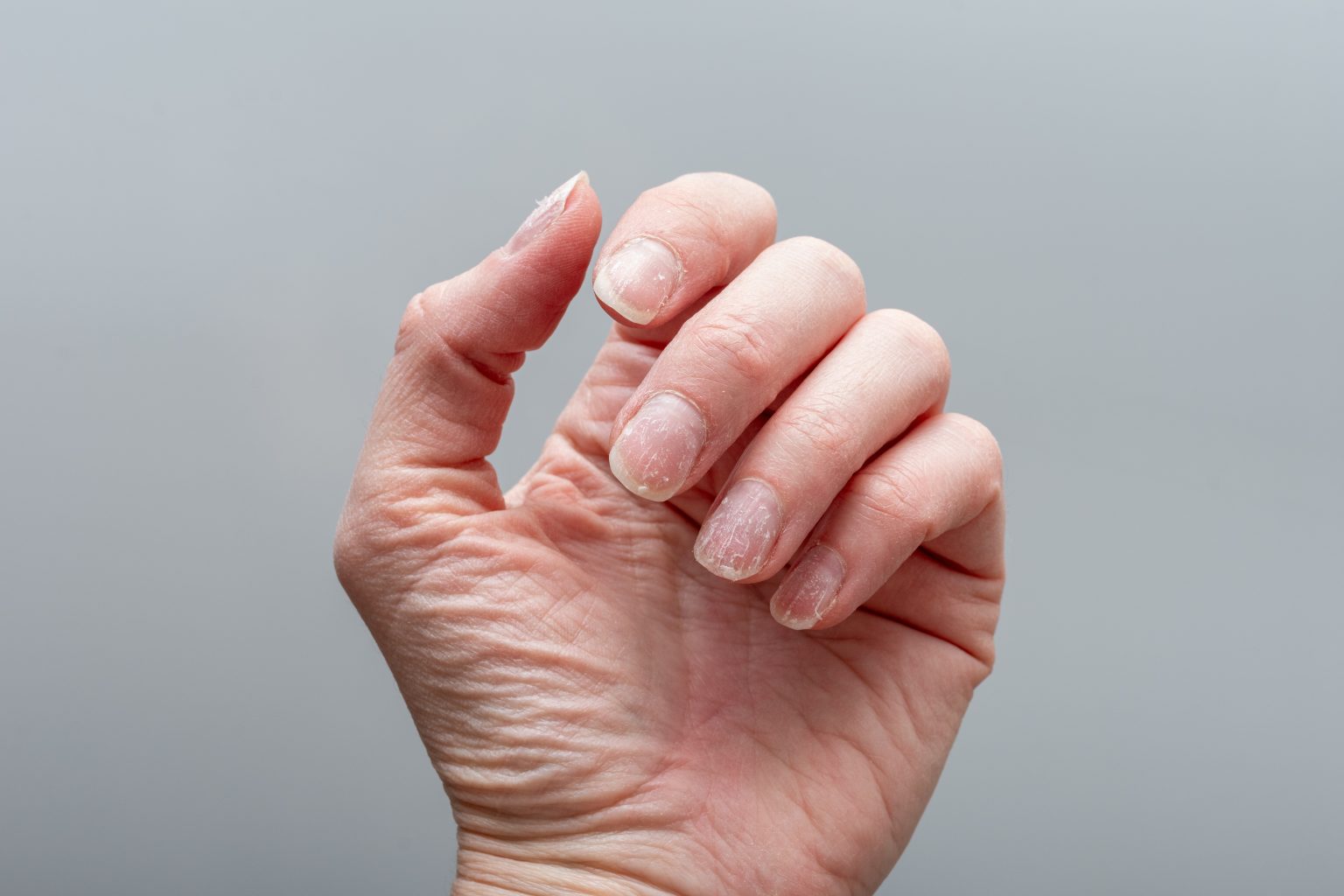 Your Finger Length Predicts Your Brain Size – Health Insight